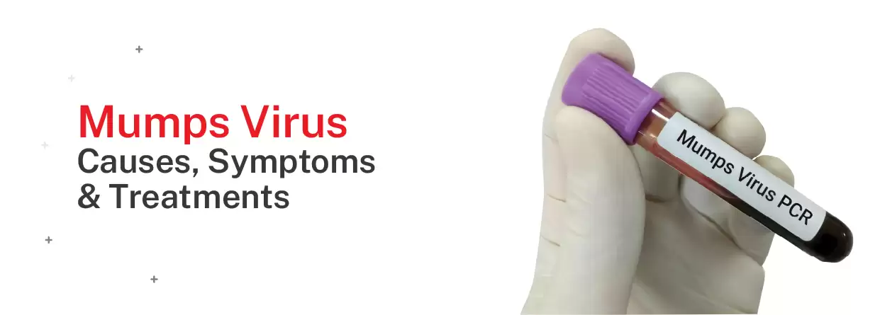 Mumps Virus: Causes, Symptoms & Treatments | CK Birla Hospital